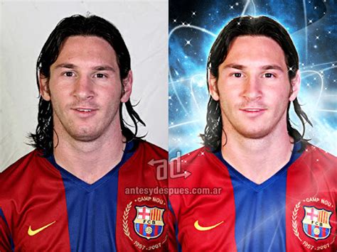 Belleza Y Moda De Las Celebridades Antes Y Despues De La Cirujia