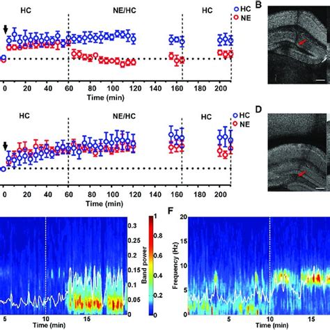The Hippocampal Trisynaptic Circuit Based On Extensive Anatomical And Download Scientific