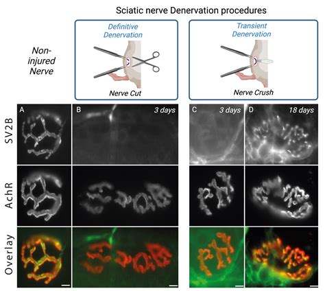 Simple Methods For Permanent Or Transient Denervation In Mouse Sciatic