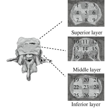 Of Trabecular Bmd Of Thoracic And Lumbar Vertebral Bodies Between 41 50 Download Scientific
