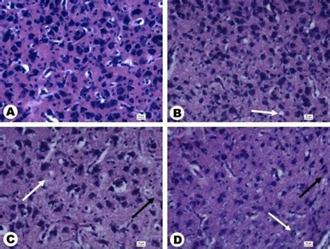 Cross Sections Through The Granular Layer Of The Cerebral Cortex Download Scientific Diagram