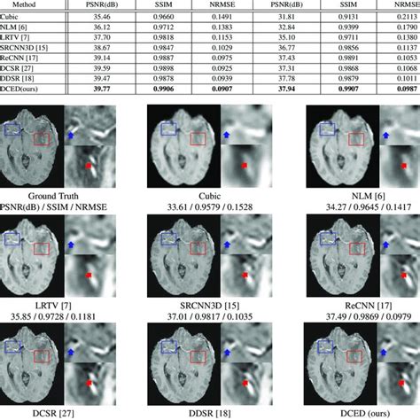 The Procedure Of Geometric Self Ensemble 3d Wavelet Fusion Method The Download Scientific