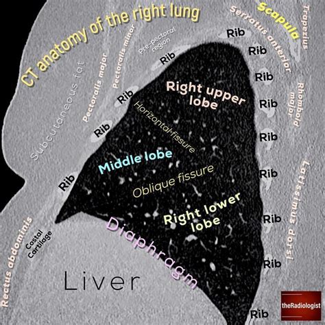 👨🏽‍💻a Sagittal View Of The Right Lung And The Position Of The Oblique And Horizontal Fissures On