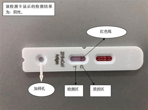 抗原检测结果怎么看阴性是几条杠 条带 显示 阳性
