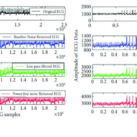 For Collected More Samples Ecg Signal Pre Processing Is Plotted For