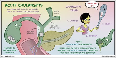 Cholangitis Core Em Cholangitis Core Em