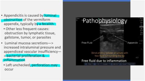 Emed Block 3 Acute Appendicitis Flashcards Quizlet