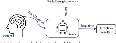 Figure 1 From An Epileptic Eeg Detection Method Based On Data Augmentation And Lightweight