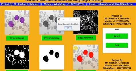 Matlab Code For Blood Cancer Detection Using Image Processing Low Price Projects