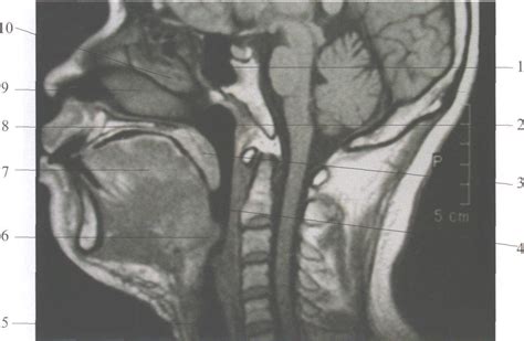 图10 203 正中矢状切面CT 口腔颌面及颈部临床解剖学 医学