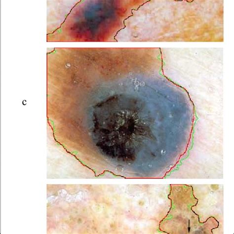 Sample Border Detection Results For The Proposed Method Green Download Scientific Diagram