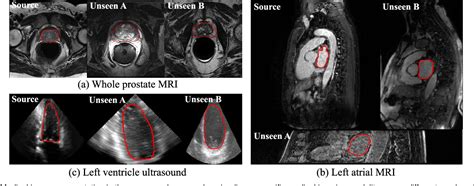 Figure 1 From Generalizing Deep Learning For Medical Image Segmentation