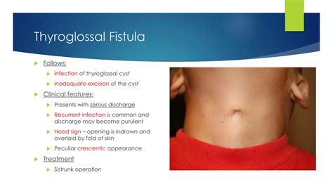 Thyroid Basics And Benign Diseases Ppt