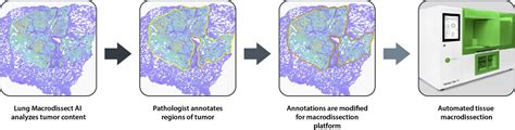 Lung Macrodissect Ai Indica Labs