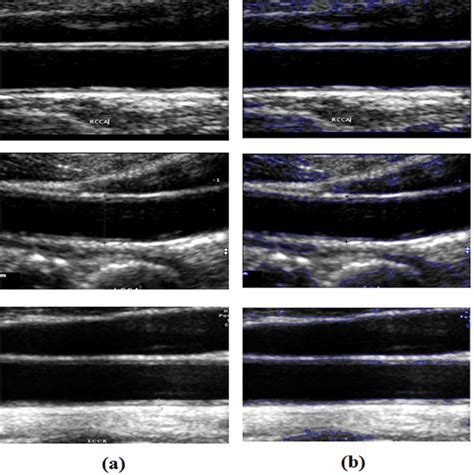 generalized edge detection a original image b segmented image