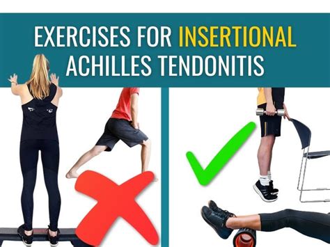 Exercises For Insertional Achilles Tendonitis Require A Different Approach