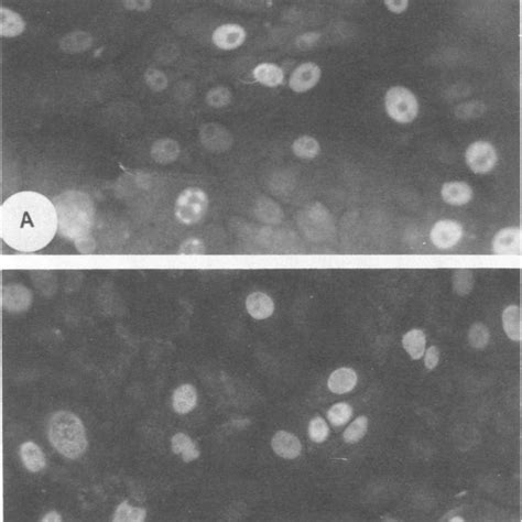 Immunofluorescent Staining Ofpersistently Infected Bk Hfb Cells