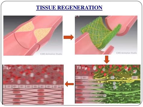 Biodegradable Ceramics Polymer Matrix Composite For Bio Medical Appli