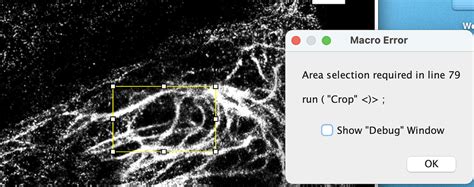 Image J Rectangular Selection And Oval Selection Giving Me Different Results Usage And Issues