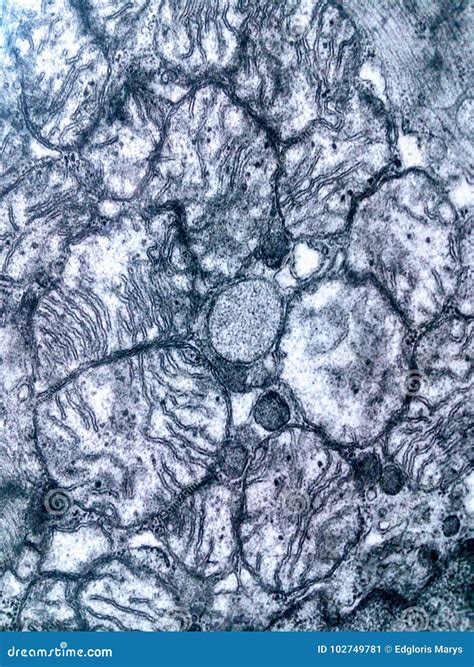 Mitochondria Electron Micrograph