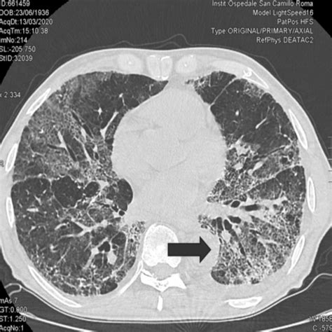A Input Image Of A Human Body Cross Section Scan B Edge Detection