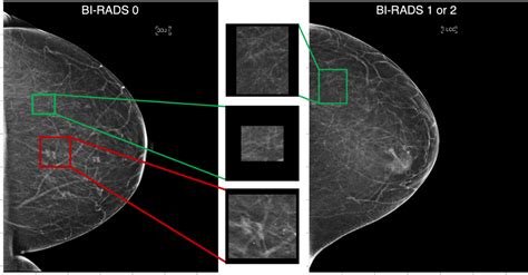 Figure From Performance Gaps Of Artificial Intelligence Models Screening Mammography Towards