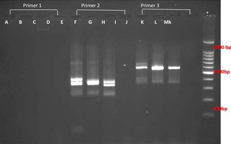 Figure 1 From Detection The Genetic Relation Between Several Fungal Isolates By Using A
