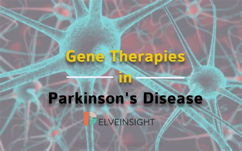 Parkinsons Disease 5 Stages Risk Factors Prevention Gene Therapy
