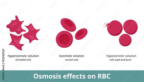 Osmosis Effect On Red Blood Cells Depending On Solution Concentration