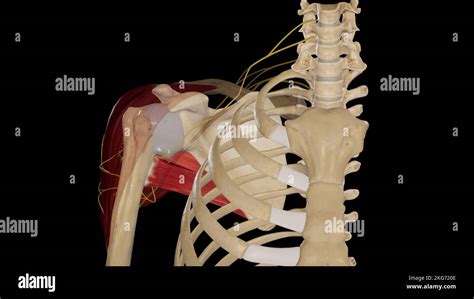 Anterior Shoulder Dislocation Axillary Nerve