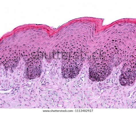 107 Imágenes De Granulation Tissue Microscopy Imágenes Fotos Y Vectores De Stock Shutterstock