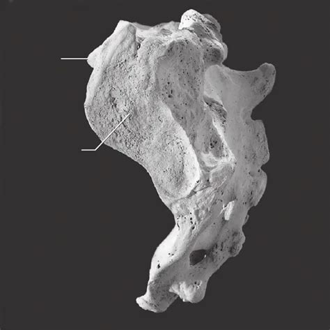 Sacrum Lateral Diagram Quizlet