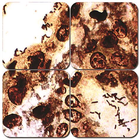 Warthin Starry Stain Kit Modified Stat