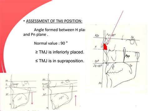 Schwarz Analysis Mothi Krishna Pptx Dental Health Diseases And
