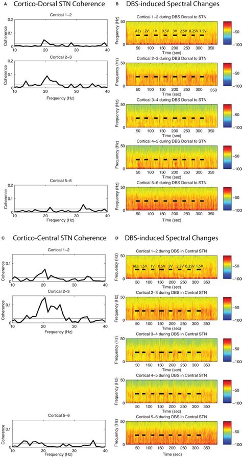 Figure A1 Spectral Attenuation In Ipsilateral Motor Cortex Of Single