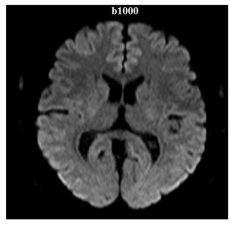 ARRT TEST PREP Flashcards Quizlet