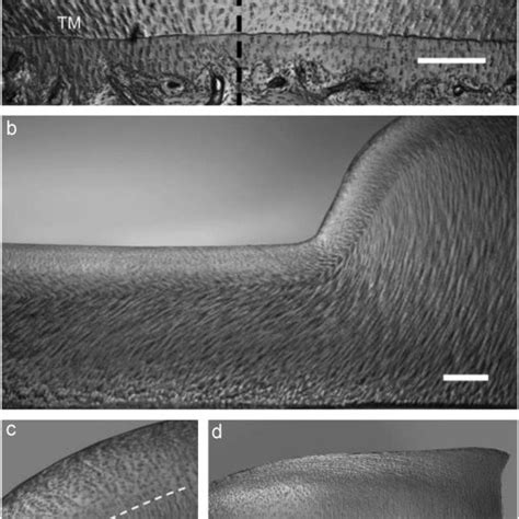 The Complex Restructuring Of The Collagen Meshwork Under Static Download Scientific Diagram