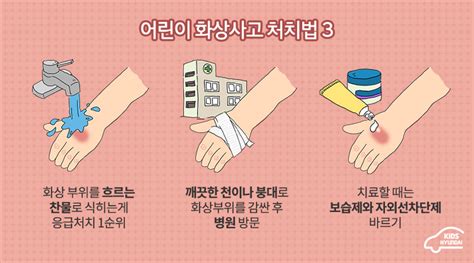 아이들이 가정에서 화상을 당했을때 대처방법