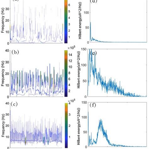 Hs And Hms Of Ictal And Interictal Eeg A Hs Of Interictal Eeg Bc Download Scientific