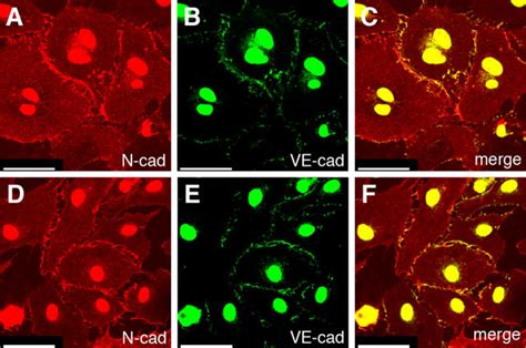 N Cadherin Acts Upstream Of Ve Cadherin In Controlling Vascular