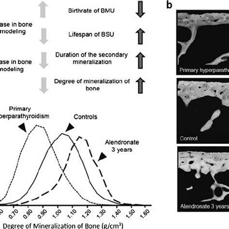 Pdf Bone Mineralization From Tissue To Crystal In Normal And Pathological Contexts