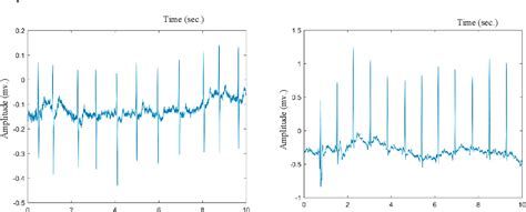 Figure 2 From P Wave Detection Using A Fully Convolutional Neural