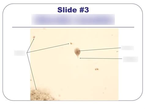 Giardia Lamblia Diagram Quizlet