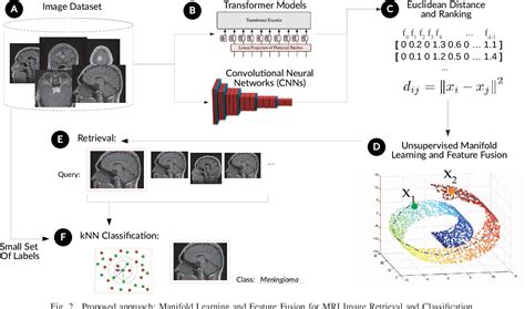 Figure 2 From Manifold Learning For Brain Tumor Mri Image Retrieval And