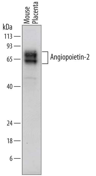Angiopoietin 2 Products