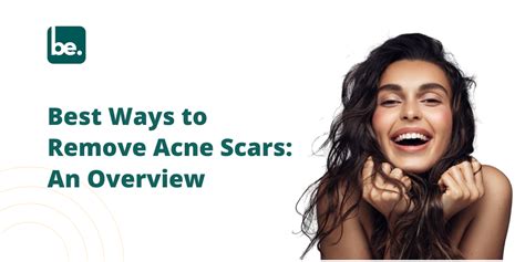 Best Ways To Remove Acne Scars An Overview Belogical Wellness