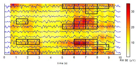 Human Recordings And Analysis Litt Lab