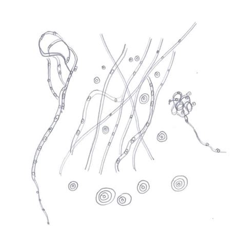 What Exactly Are Eye Floaters Jim On Light