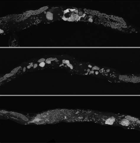 Cep 1 P53 Dependent Dysplastic Pathology Of The Aging C Elegans Gonad Figure F3 Aging
