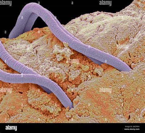 Threadworms In The Gut Coloured Scanning Electron Micrograph Sem Showing Threadworms